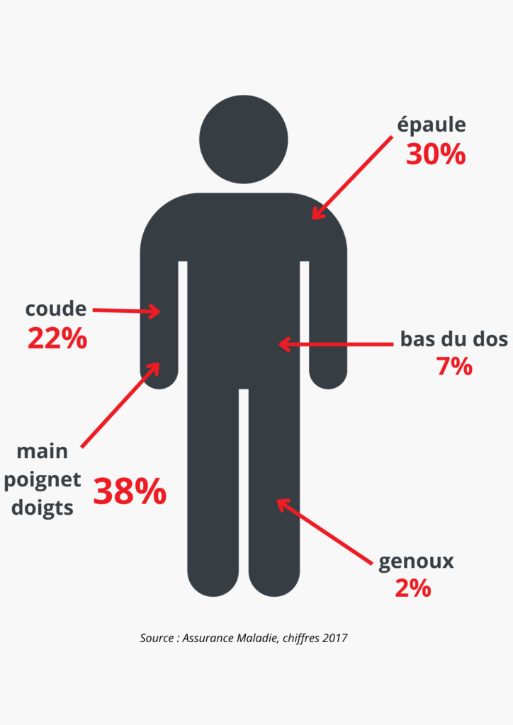 Zoom sur les différents TMS. - Liftop